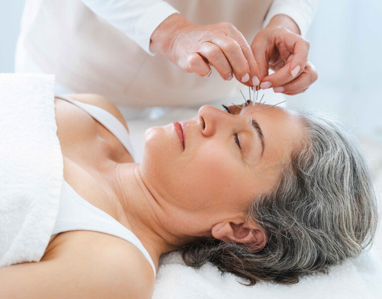 Acupuncture | The Foundation for Peripheral Neuropathy